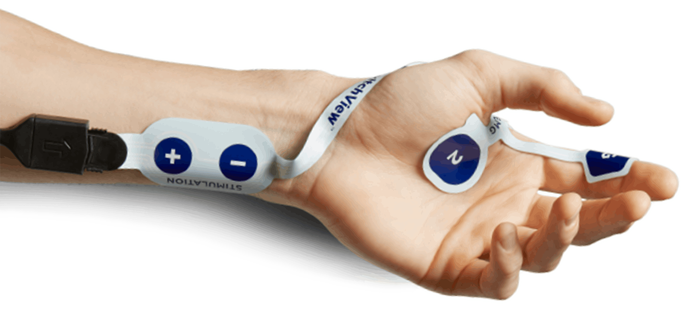 TwitchView™ – LTR Medical